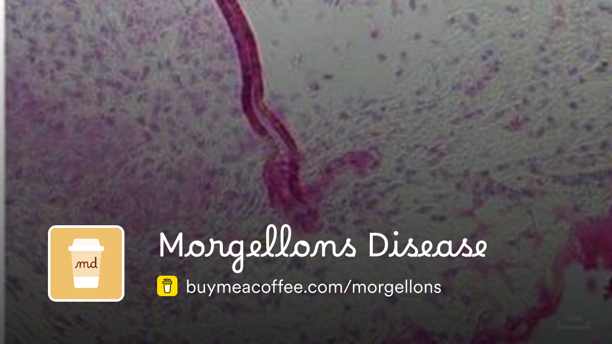 Morgellons Disease is raising awareness for the Morgellons condition ...