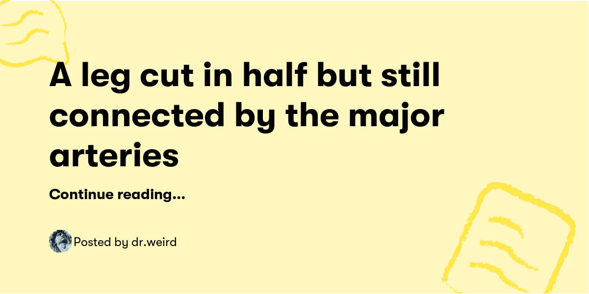 A leg cut in half but still connected by the major arteries — dr.weird ...