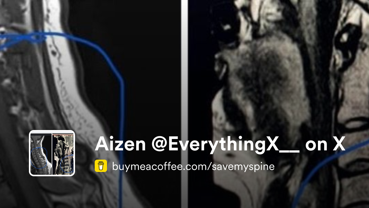 Aizen @EverythingX__ on X is Articles in collaboration with Grok on X ...