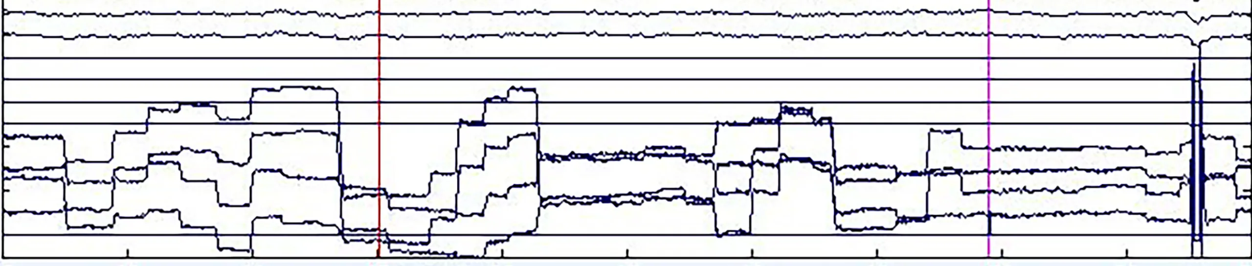The "EYE-EEG" Toolbox is making simultaneous eye-tracking/EEG easy ...
