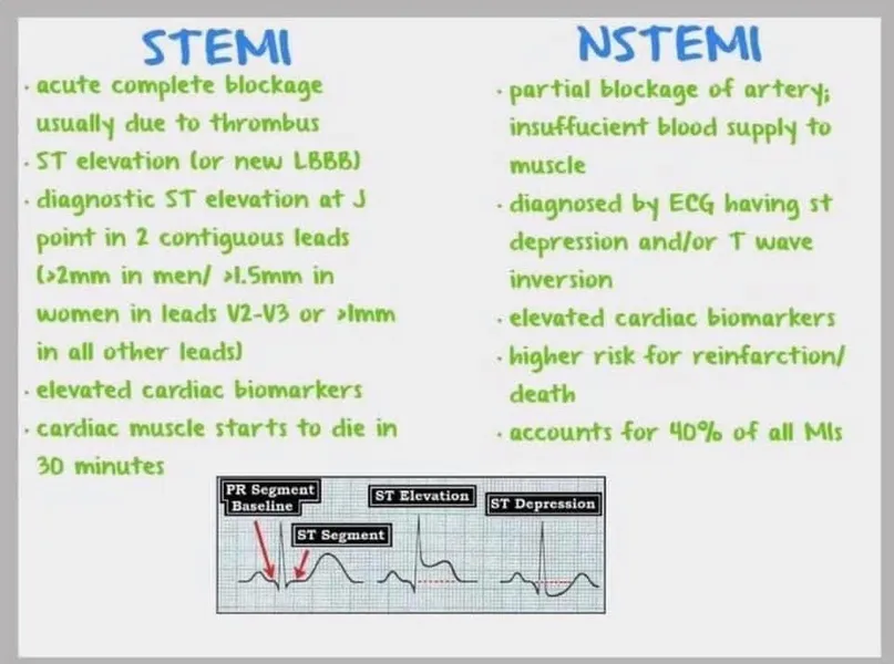 Stemi vs. Nstemi — ERnurseology