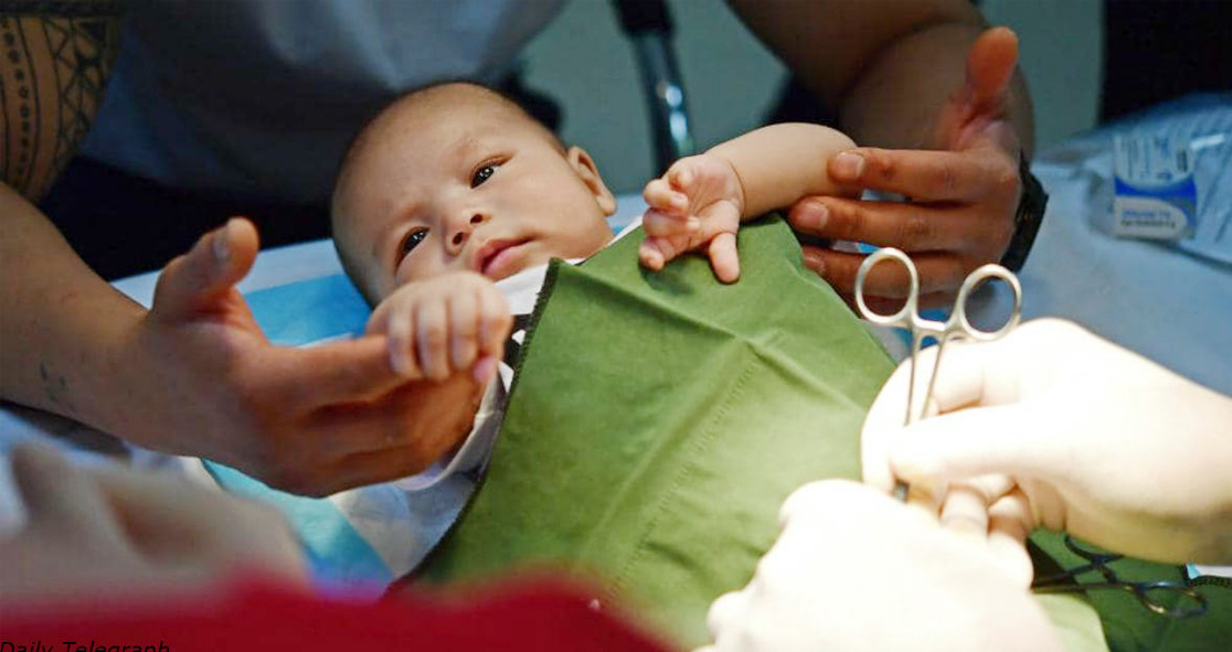 Chordee, abnormalcy, and penile torsion in babies — Health Tips