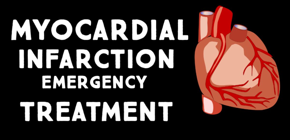 Myocardial Infarction Slides - Buymeacoffee